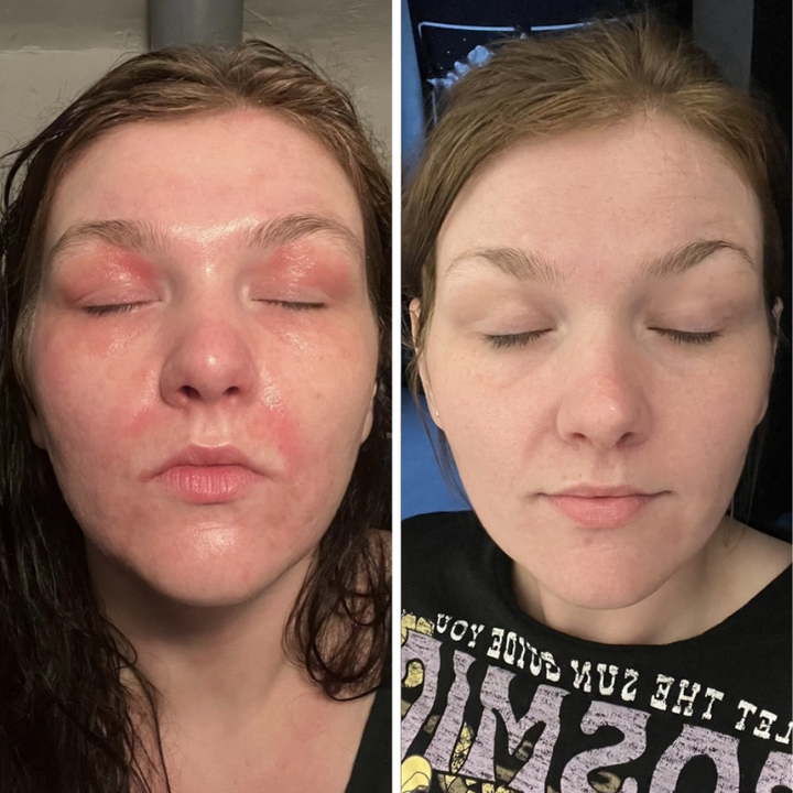 Virtual Skin Consults – Three Ships